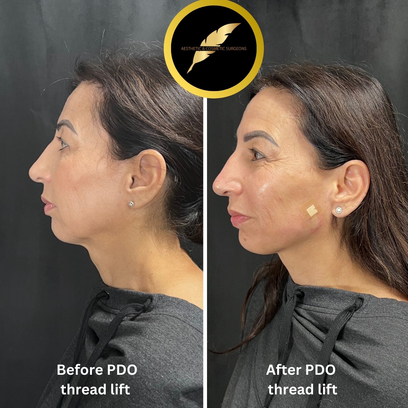 Aesthetic and Cosmetic Surgeons Portfolio