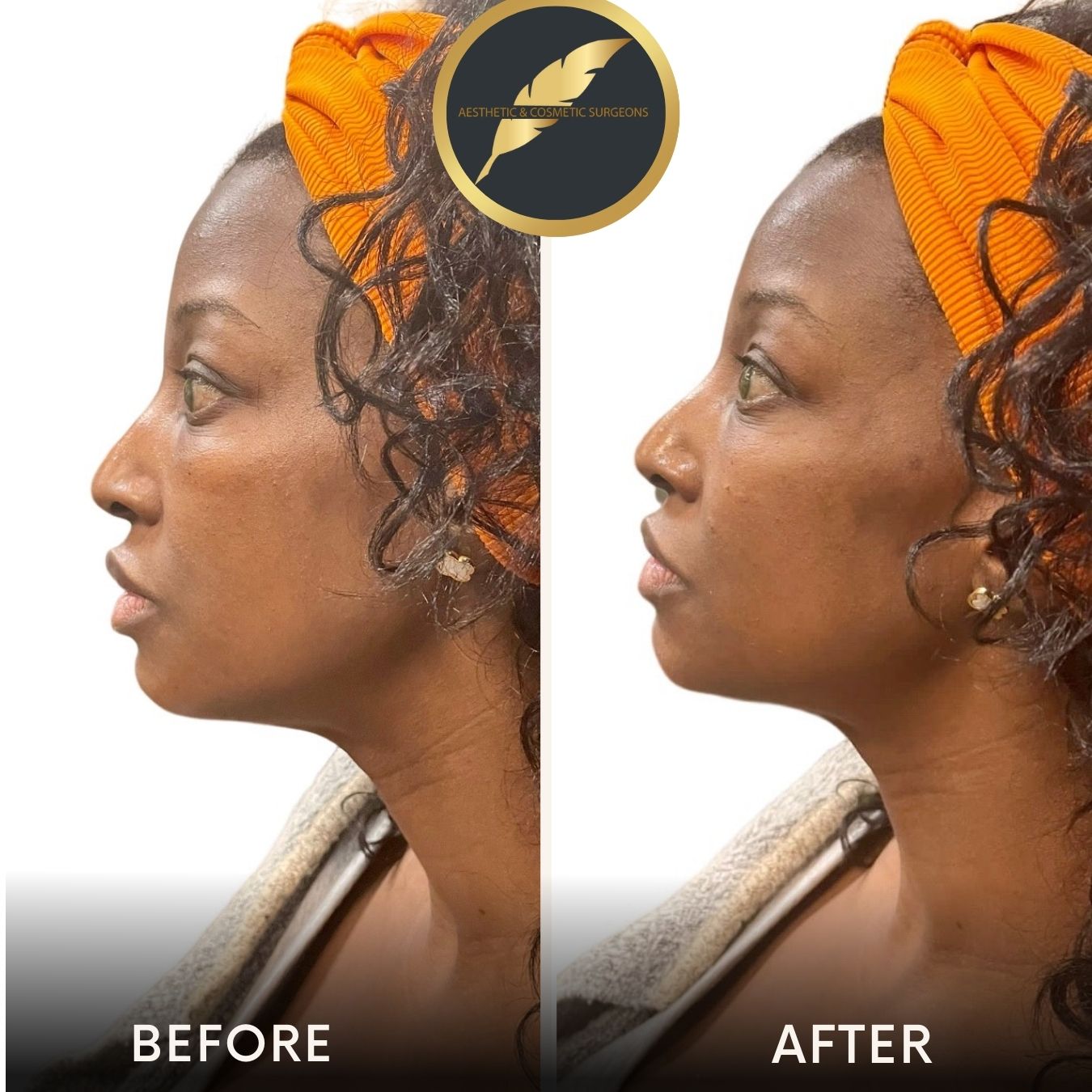 Aesthetic and Cosmetic Surgeons Portfolio